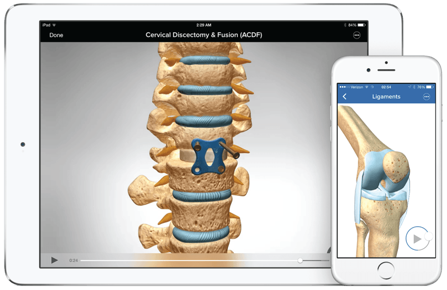 Can 3D Animations Improve Patient Engagement at the Point of Care?