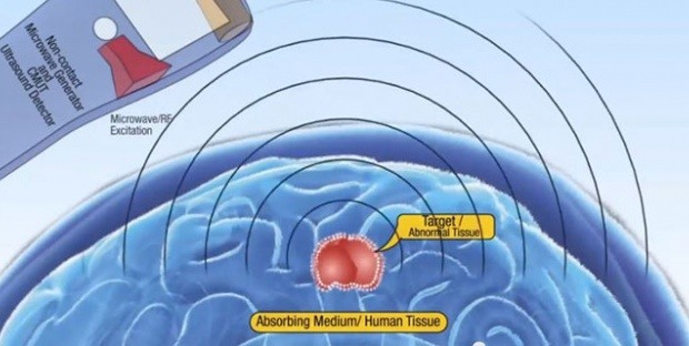 Stanford Engineers Test Tricorder-Like Detector for Tumors