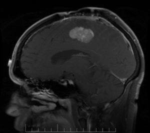 Mayo Clinic, GE Set to Unveil Innovative Compact MRI Scanner