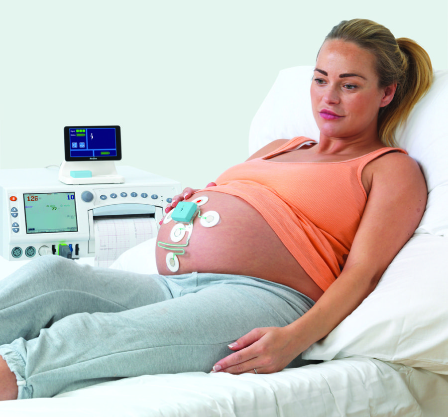GE Healthcare Acquires Fetal Monitoring Technology Monica Healthcare to ...