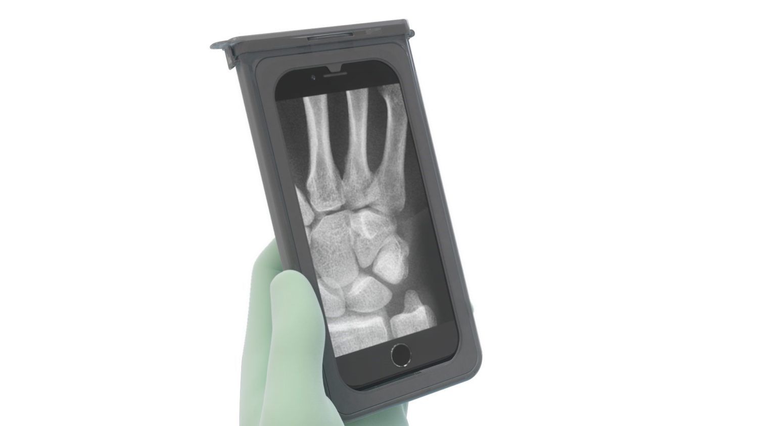 Med Student Develops Mobile Device Cover to Bring Health Apps into ...