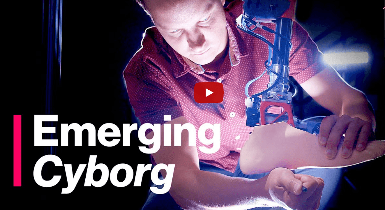 AI-Powered Bionic Leg Offers A Glimpse Into Our Cyborg Future