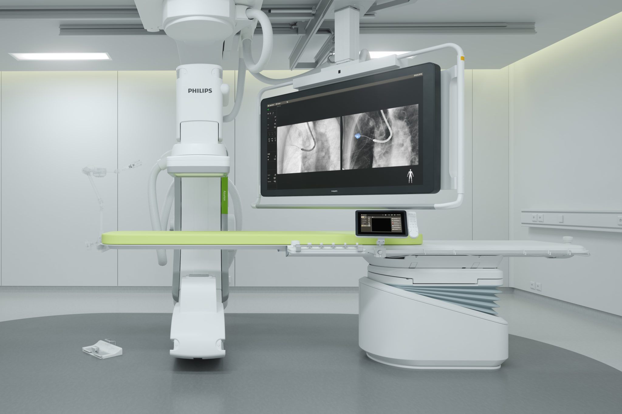 Philips Launches Advanced 3D Imaging Navigation Platform for Faster ...