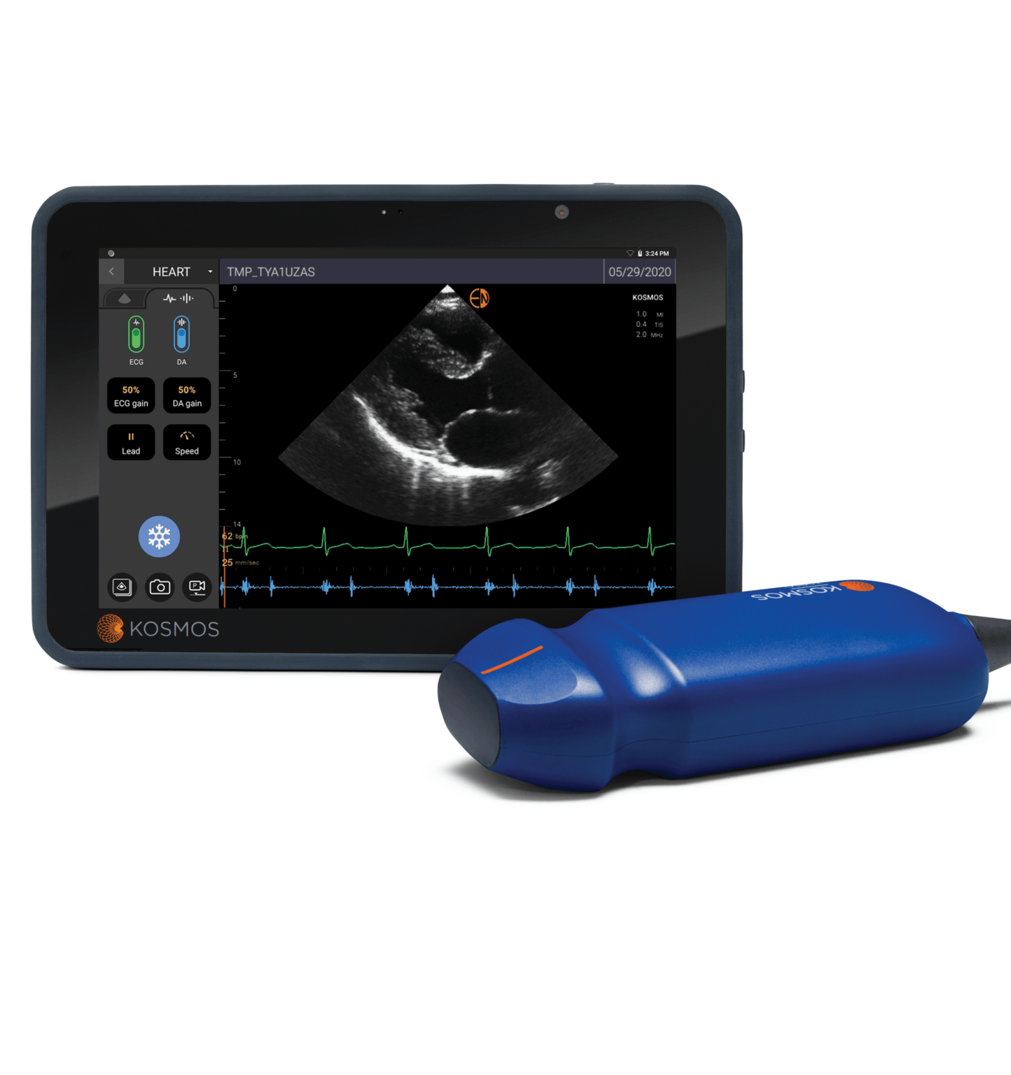 EchoNous Closes $60M for AI-Assisted Handheld Ultrasound Device