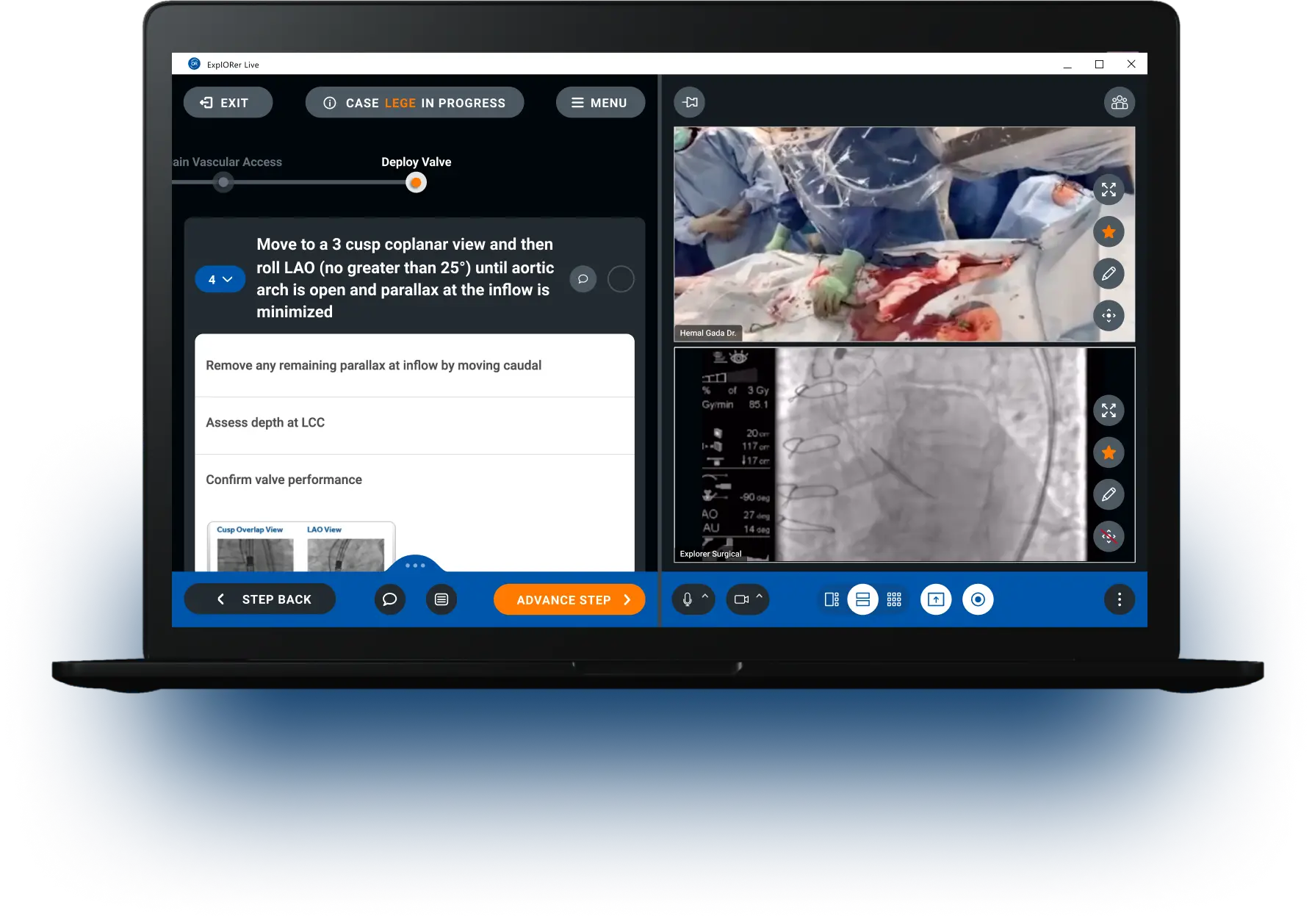 GHX Acquires Explorer Surgical: Getting Closer to the Patient