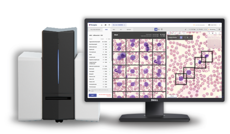 Scopio Secures $50M for AI-Powered Peripheral Blood Smear App