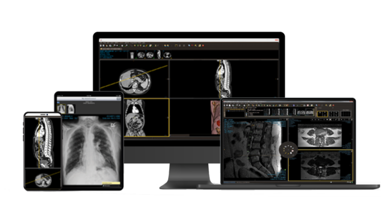 Intelerad & DiA Imaging Analysis Partner to Empower Echocardiography ...