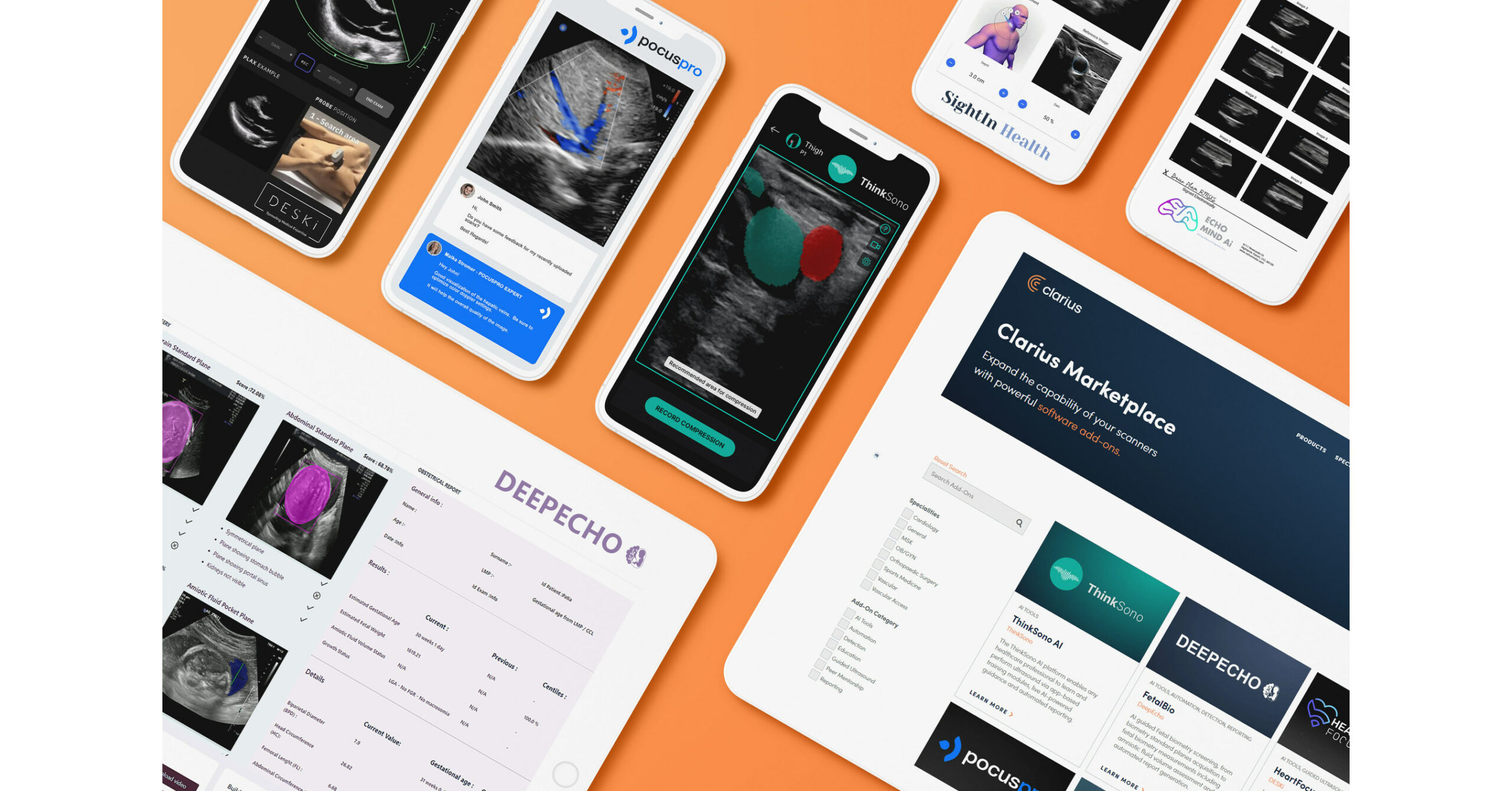 Clarius Marketplace Launches for AI Ultrasound Innovators Clarius Marketplace Launches for AI Ultrasound Innovators