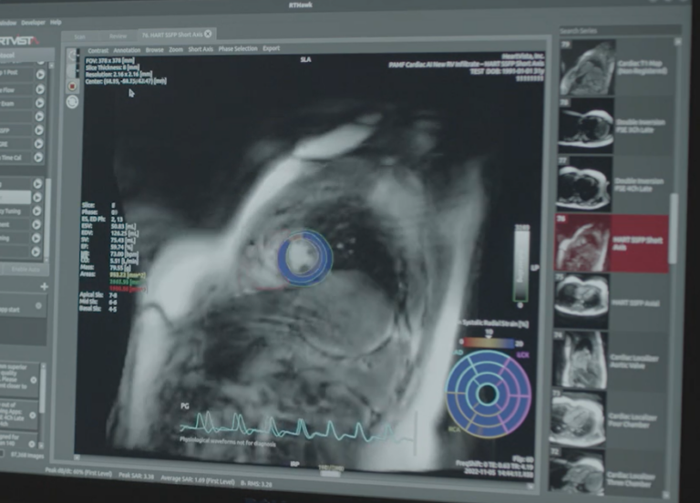 Study: AI-Guided Solution Improves MRI Scan Times & Adoption Rates