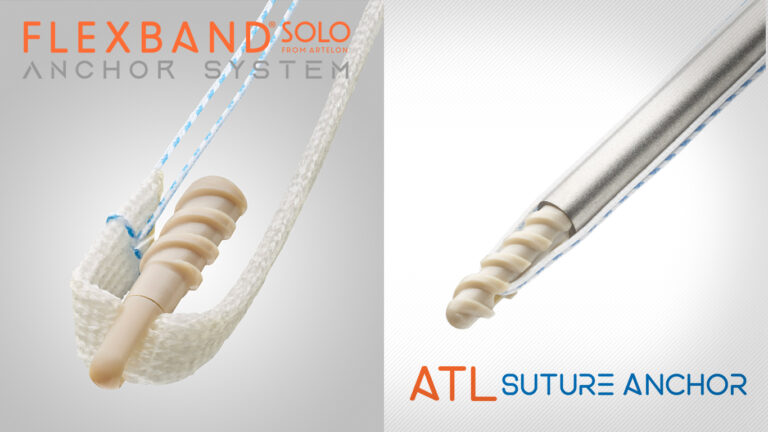 Artelon Secures $20M for Surgical Treatment of Joint Instability