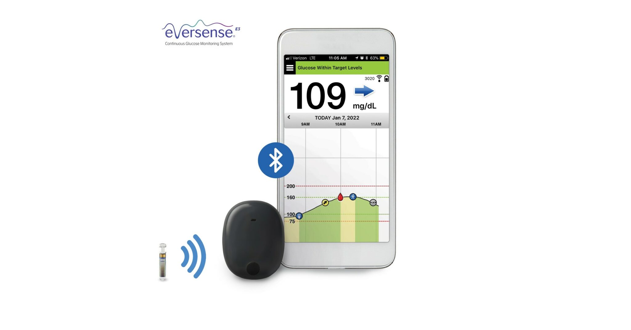 Eversense E3 Cgm For Diabetes Now Covered By Unitedhealthcare