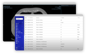 Flywheel Secures $54M for Medical AI Imaging Platform