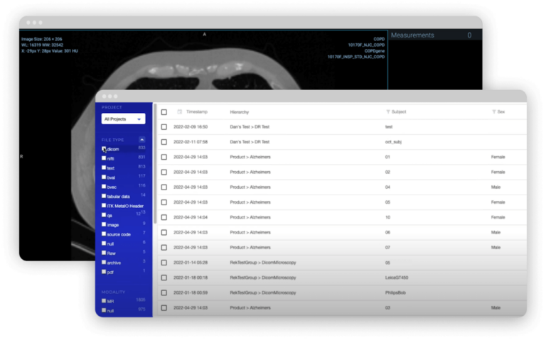 Flywheel Secures $54M for Medical AI Imaging Platform