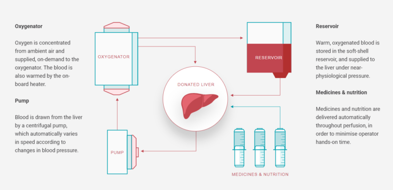 OrganOx Secures $32.6M for Liver Transplantation Device