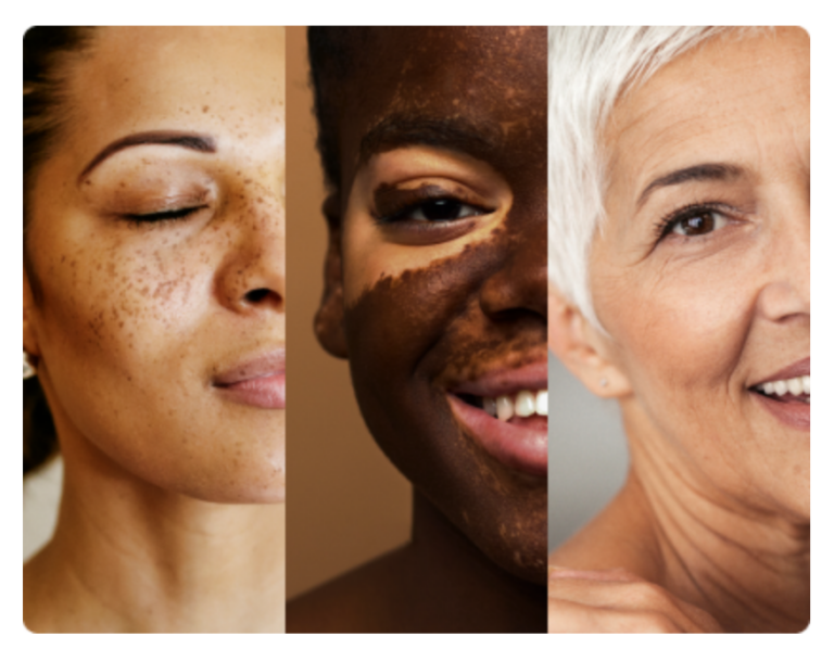 Verily & L’Oreal Launches Diverse Skin and Hair Health Registry