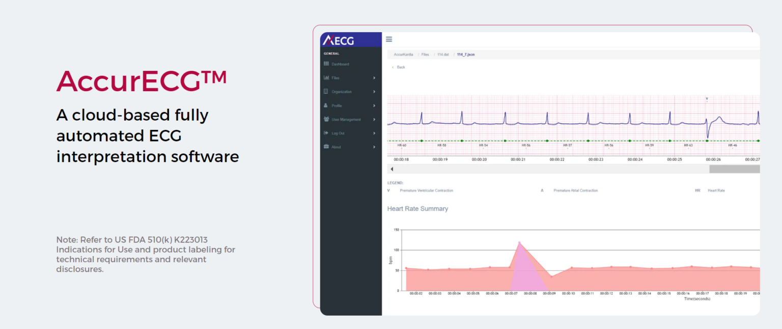 AccurKardia Brings ECG Software to Lucem Health's AI Platform