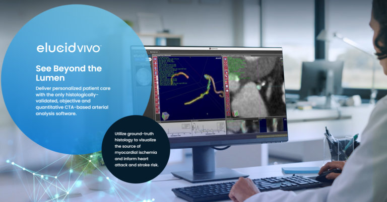 Elucid Raises $80M to Drive Commercialization of AI-powered ...