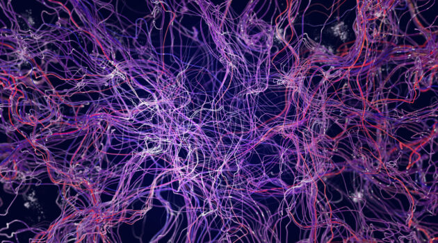 GE HealthCare Integrates with NVIDIA-Powered AI Foundation Models to ...