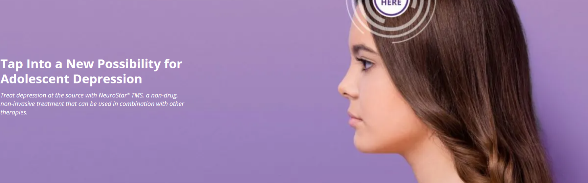 Humana Becomes First Insurer to Cover TMS Therapy for Adolescent Depression