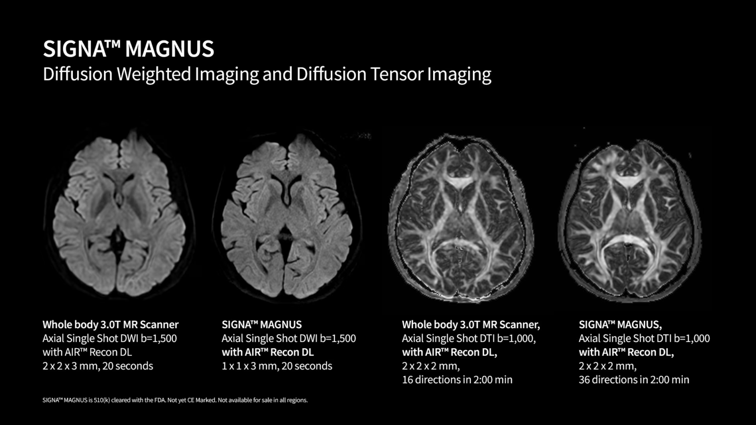 GE HealthCare Receives FDA Clearance for SIGNA™ MAGNUS Head-Only MRI ...