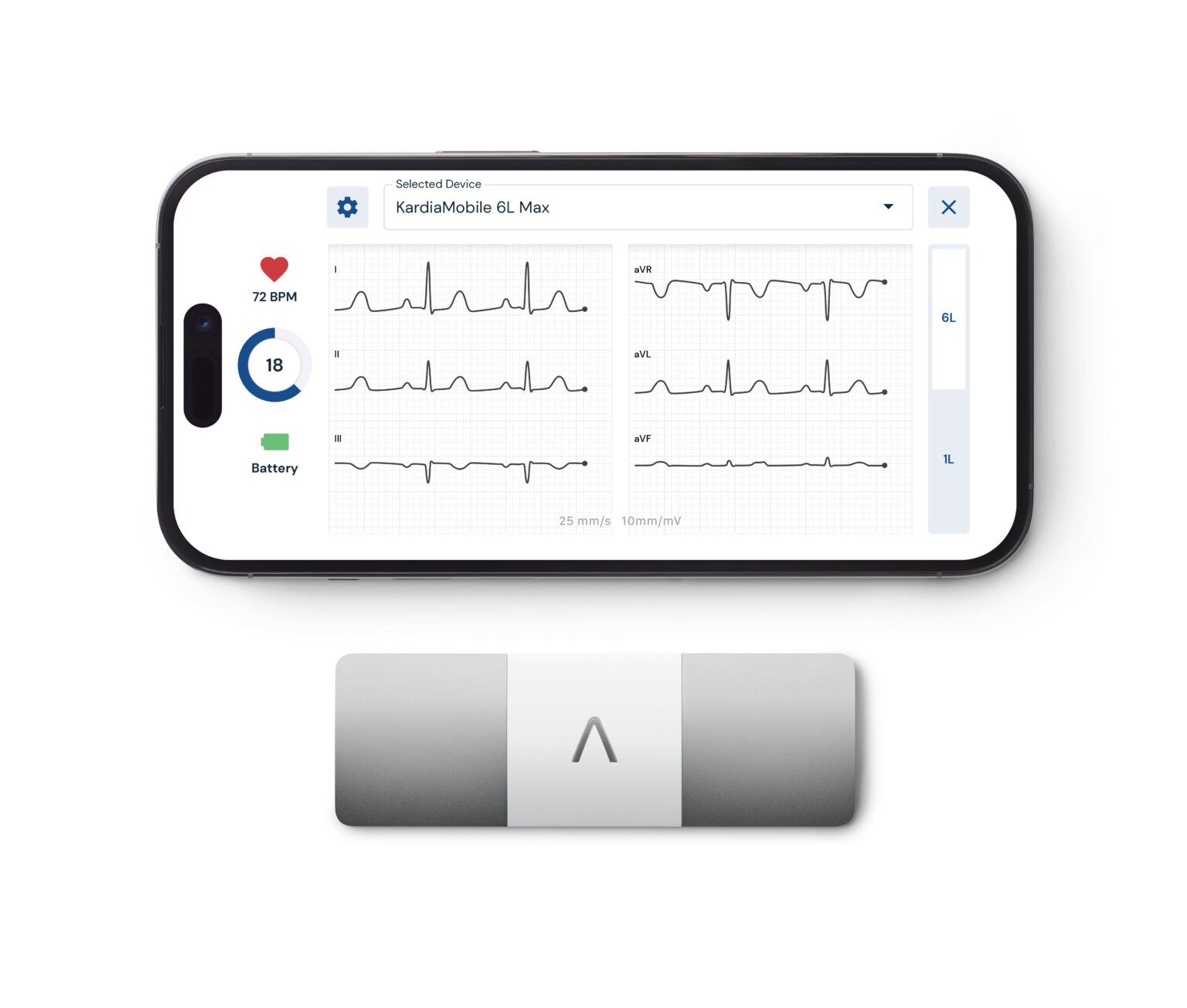 AliveCor Unveils KardiaMobile 6L Max & KardiaAlert for Heart