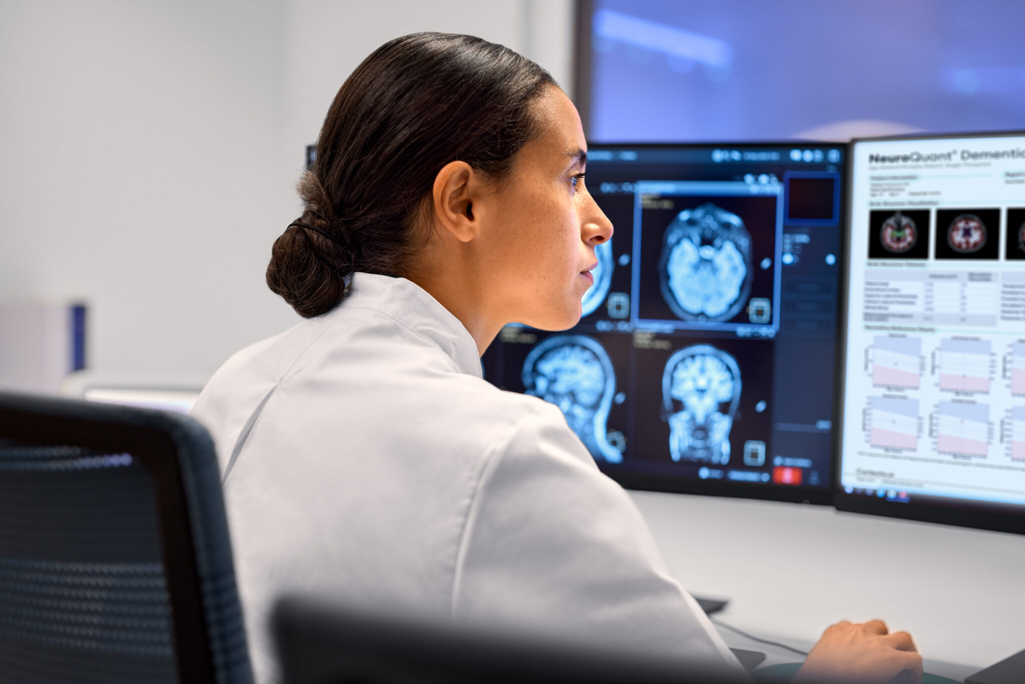 Philips and Cortechs.ai Expand Partnership to Embed AI Neuroimaging ...